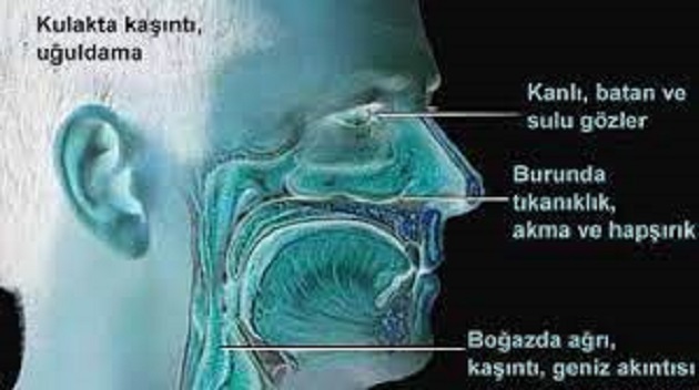 Geçmeyen öksürük ve hapşırma nedeni alerjik rinit olabilir - Sağlık ...